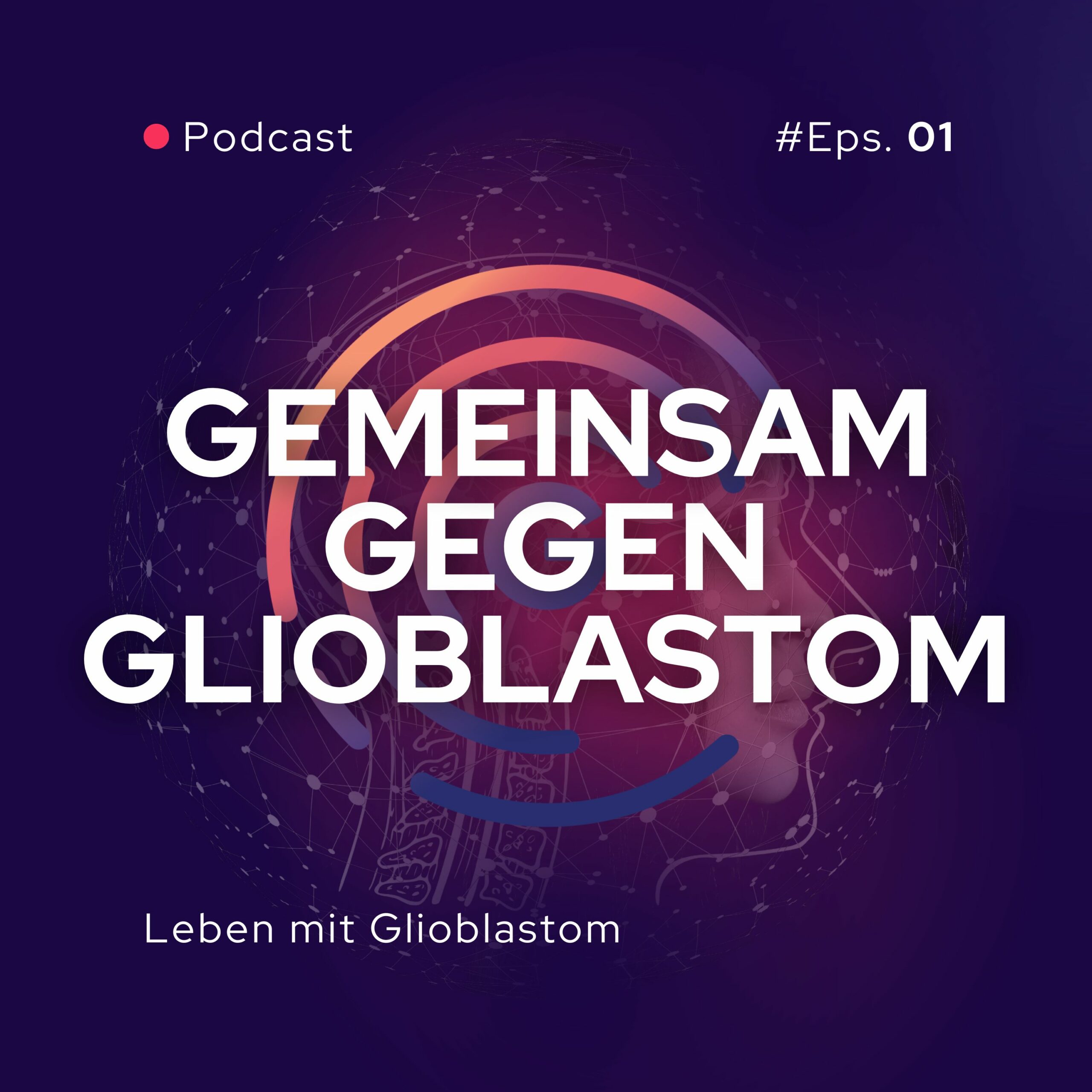 #1 Leben mit Glioblastom | Alex Ewen - InfluCancer | Wir sprechen über ...