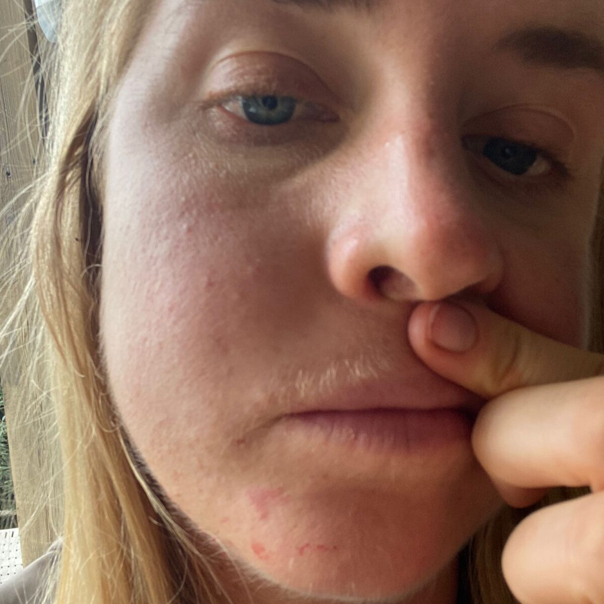 Meine Krebsgeschichte - Diagnose: Nebennierenrindenkarzinom ...